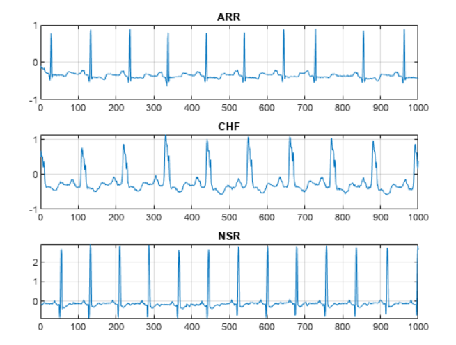 使用小波分析和深度学习对心电图 (ECG) 进行分类 - mcu-ai-com - 博客园