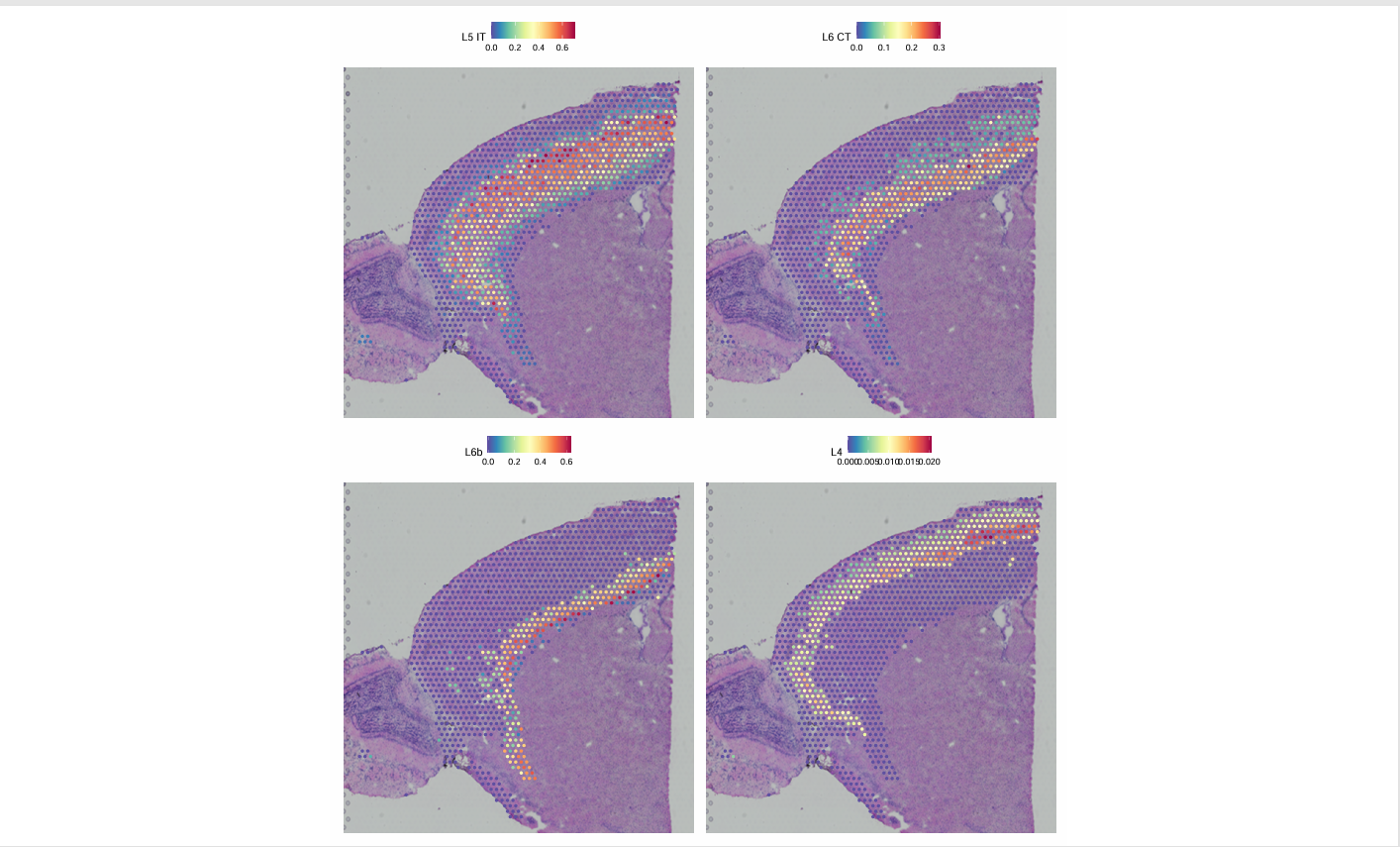 Seurat分析空间数据集（10x Visium 非HD） - Nlkjuh - 博客园